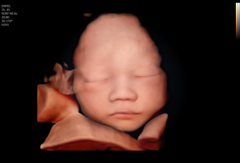 Ultrasound Image Gallery | theSUITE – Learn without Limits