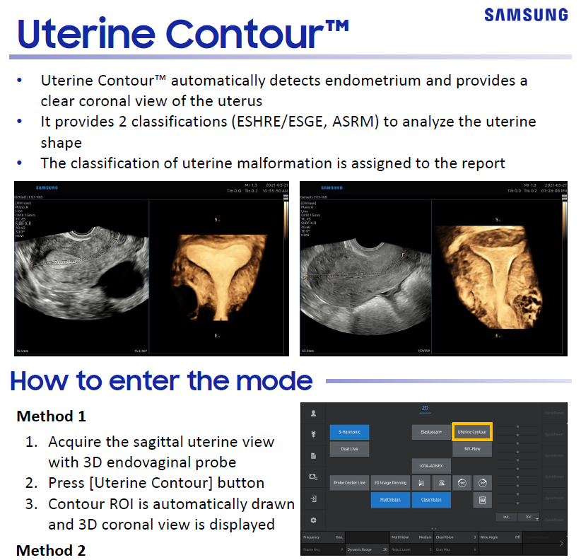 UterineContour™ for Endometrial Ultrasound: Quick Overview