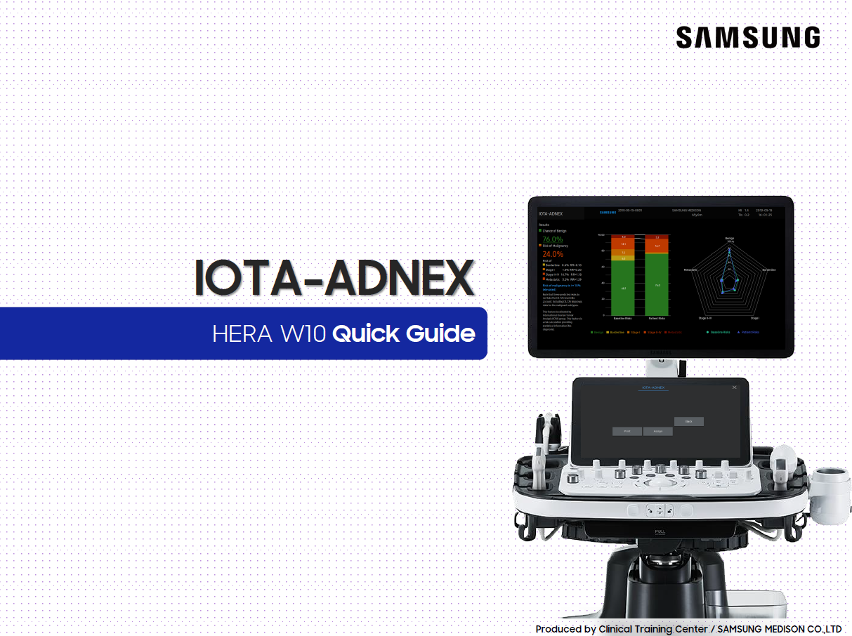 IOTA-ADNEX for Adnexal Mass Evaluation on HERA W10